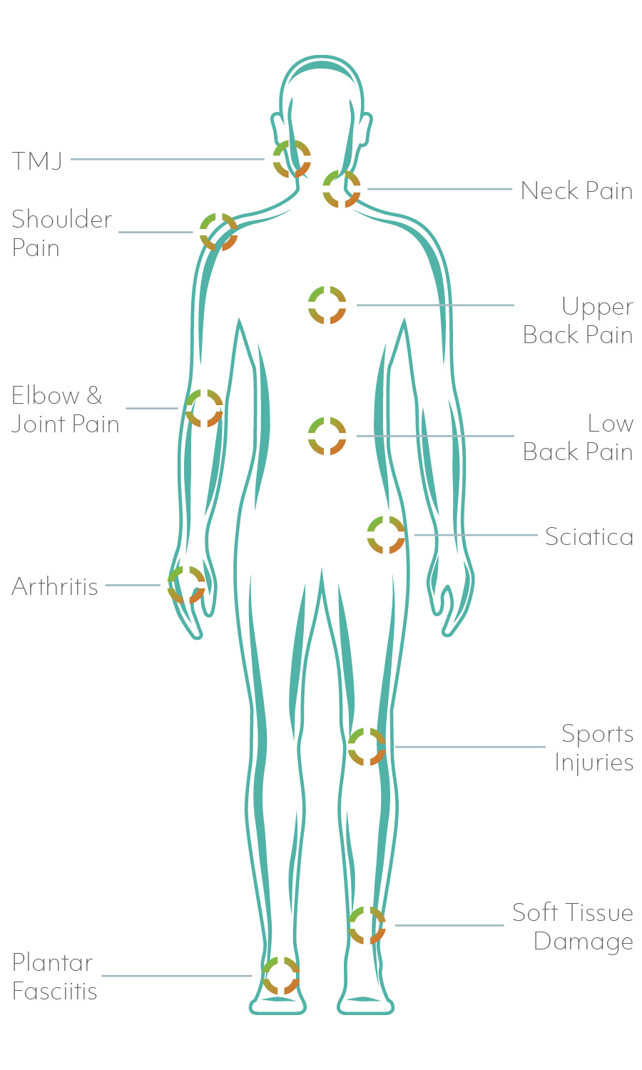 FYZICAL TPC Parkway : Laser Therapy